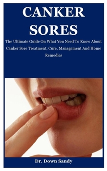 Canker Sores: The Ultimate Guide On What... book by Dr. Down Sandy