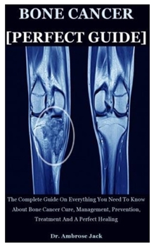 Bone Cancer [Perfect Guide]: The... book by Dr. Ambrose Jack