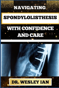NAVIGATING SPONDYLOLISTHESIS WITH... book by DR. WESLEY IAN
